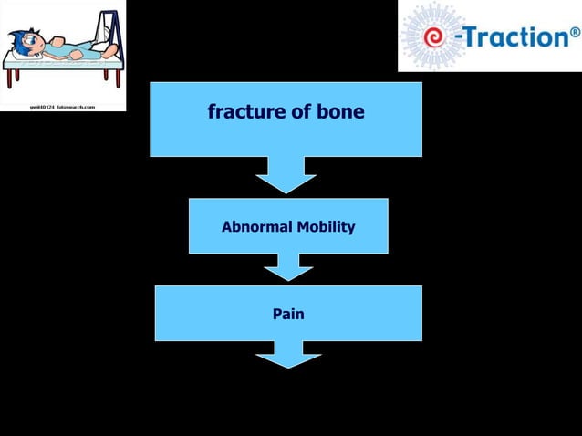 Traction JEFF_in_orthopaedics-1(1).ppt