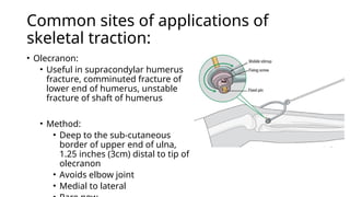 traction modified inroduction orthopedics.pptx