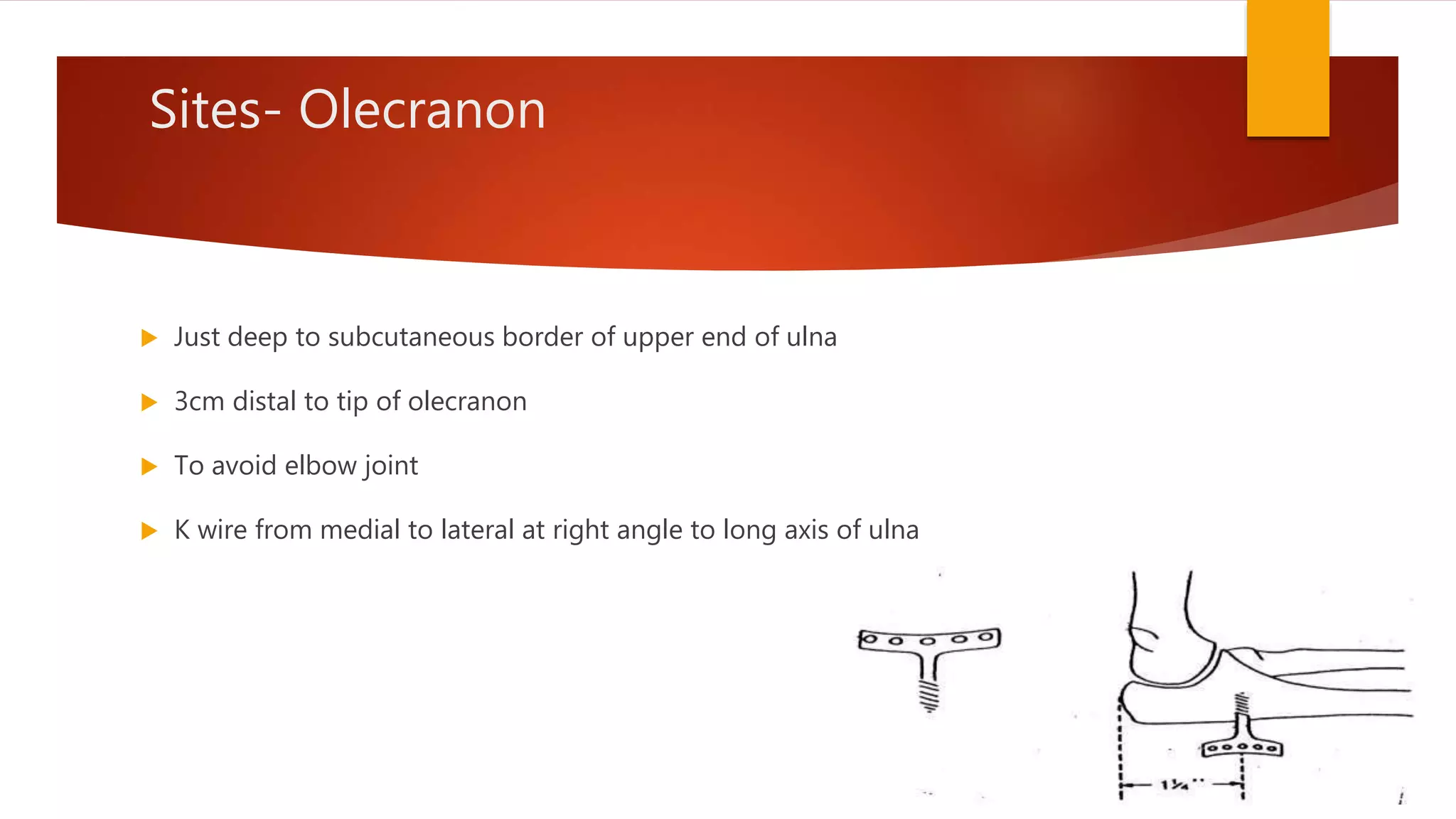 Lower Limb traction | PPTX