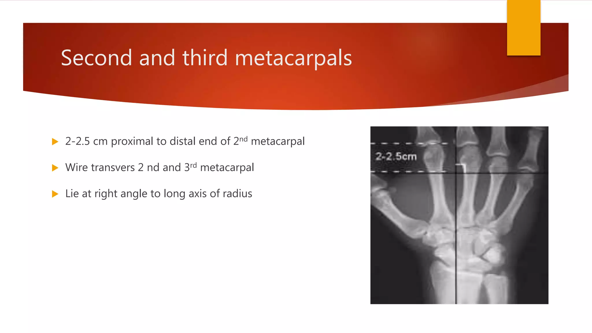Lower Limb traction | PPTX