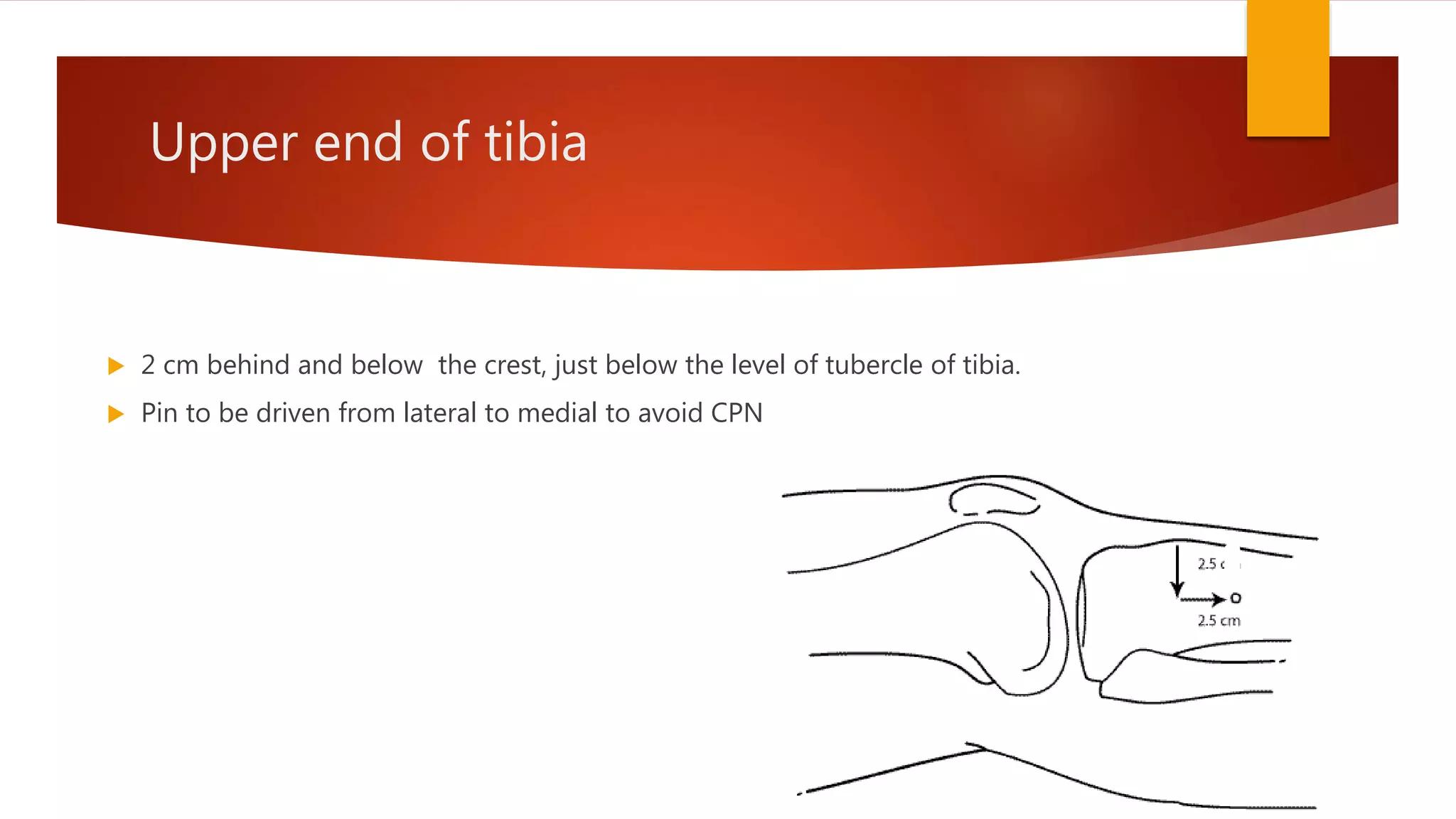 Lower Limb traction | PPTX
