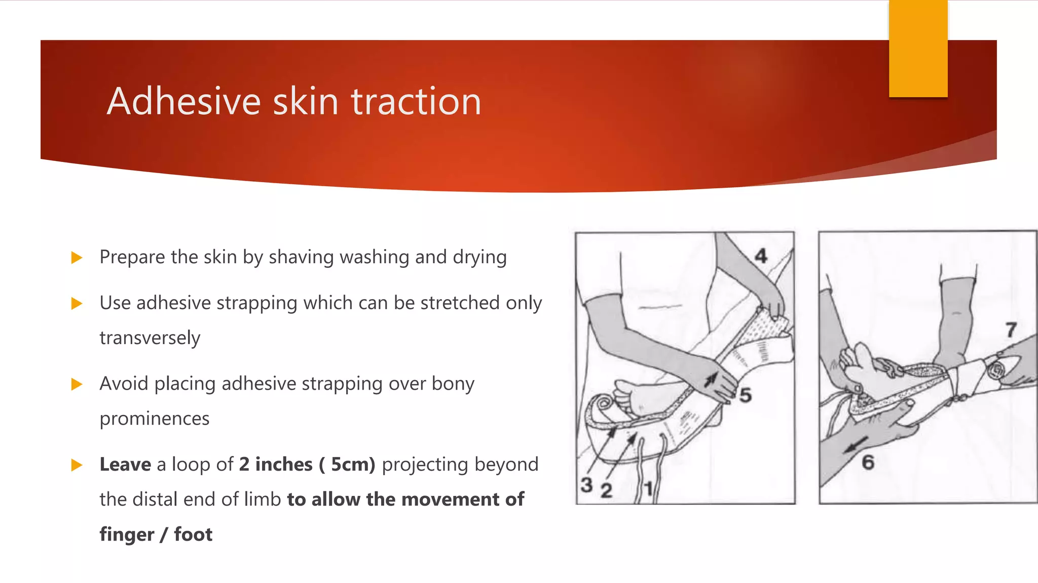 Lower Limb traction | PPTX