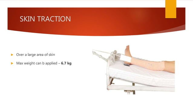 Lower Limb traction | PPT