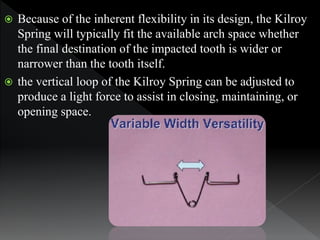 orthodonticTraction of impacted maxillary canine and Piggyback ...