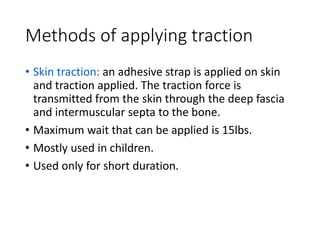 TRACTION pptx.,on 29.01.2024^_v_1_0.ppt | Death, Injury, or Military ...