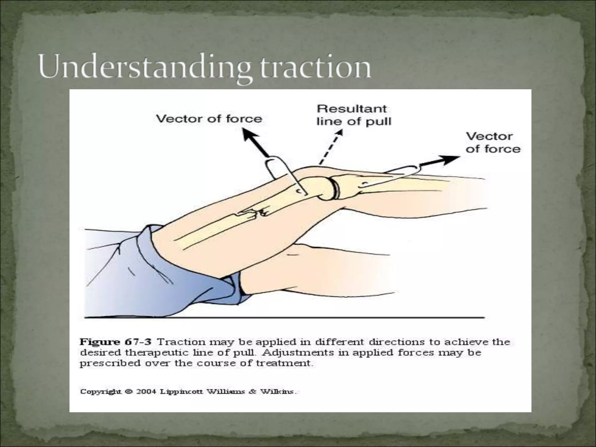 Tractions | PPT