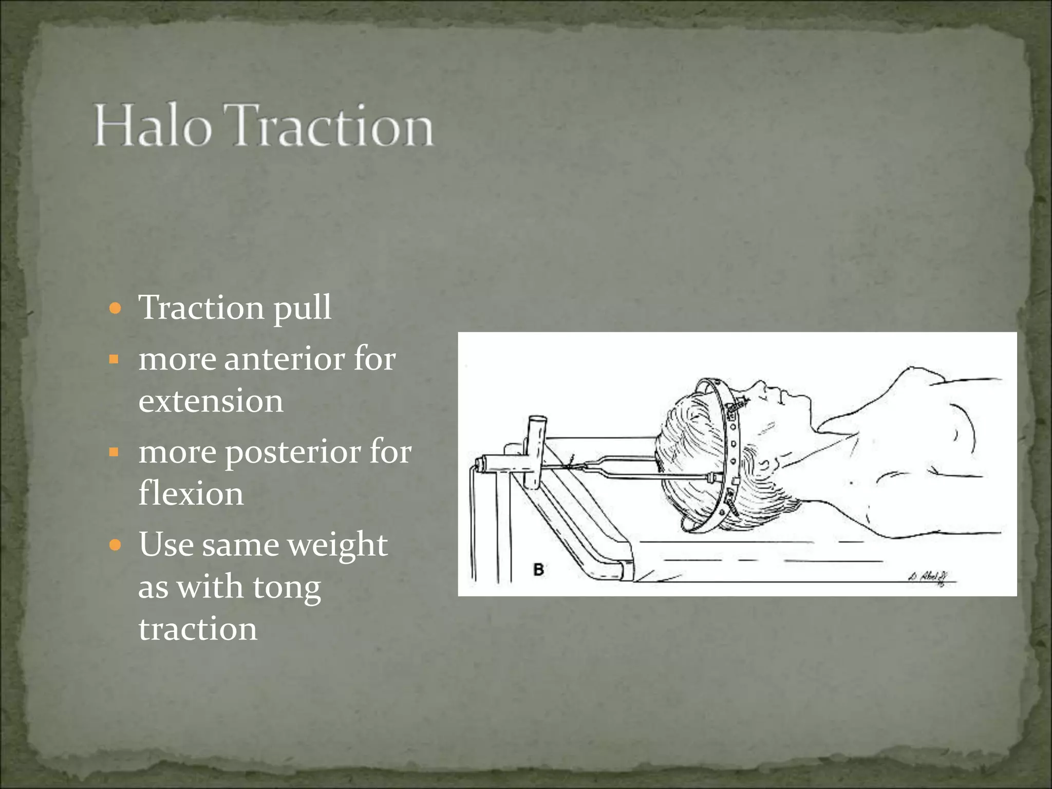 Tractions | PPT