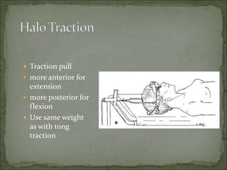 Tractions | PPT
