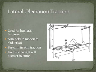 Tractions | PPT