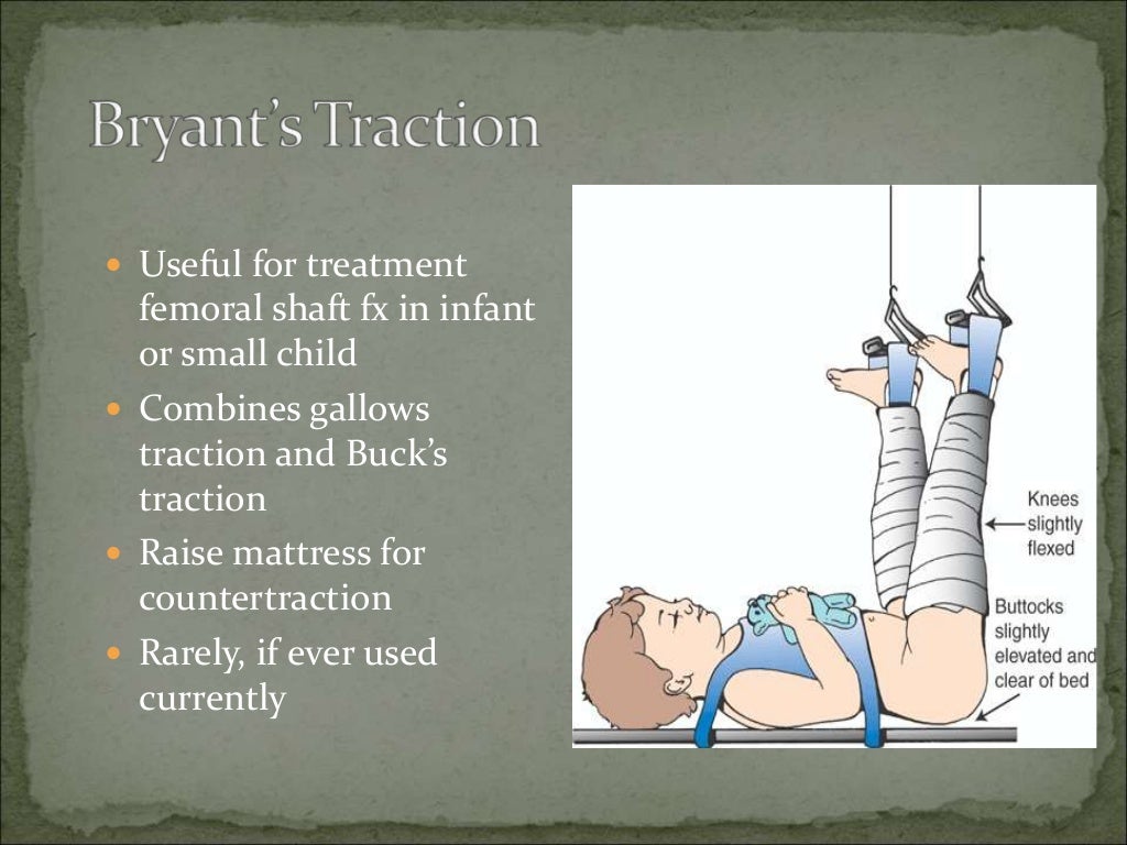 Tractions Tractions
