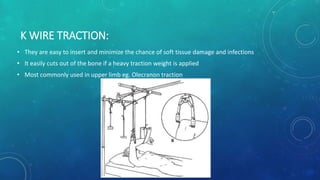 Tractions | PPTX