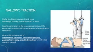 Tractions | PPT