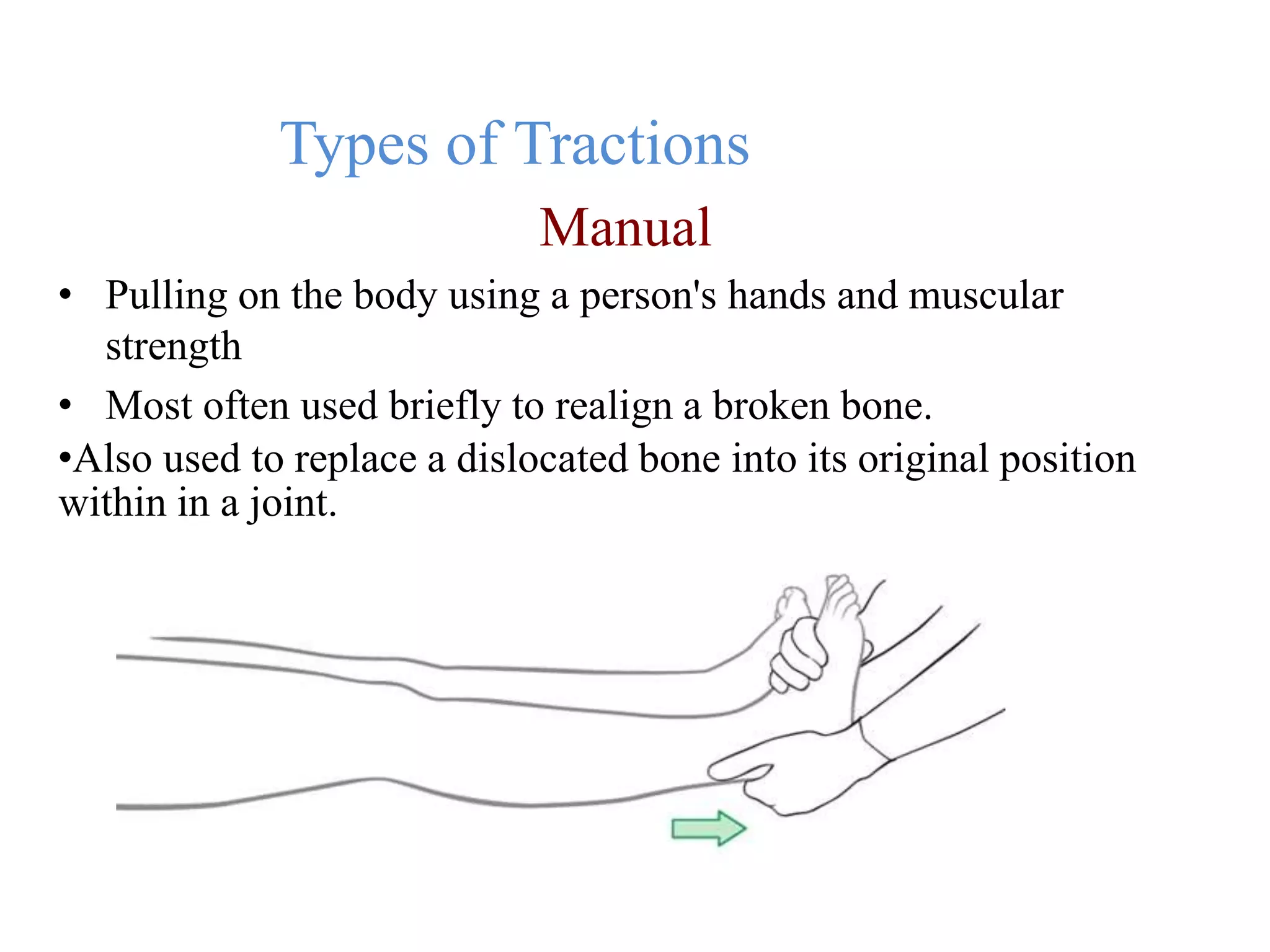 Tractions in Orthopaedics.ppt