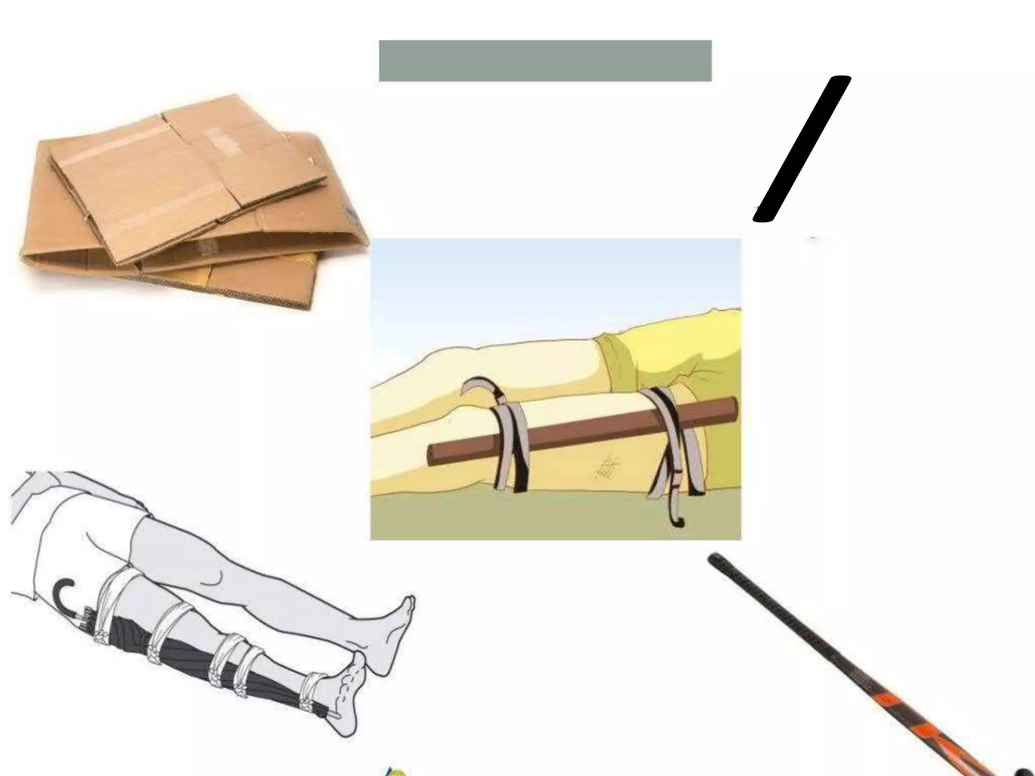 Tractions in Orthopaedics.ppt