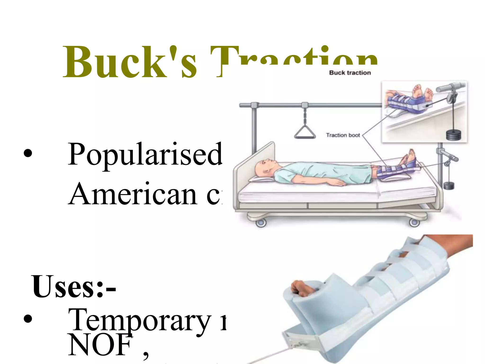 Tractions in Orthopaedics.ppt