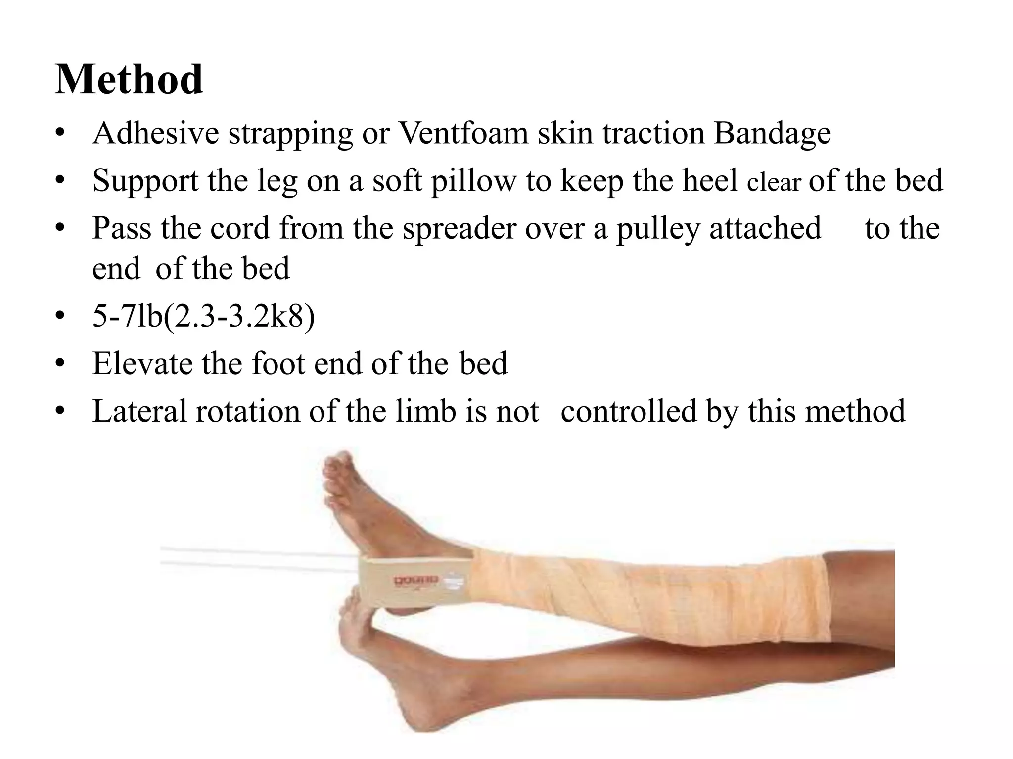 Tractions in Orthopaedics.ppt