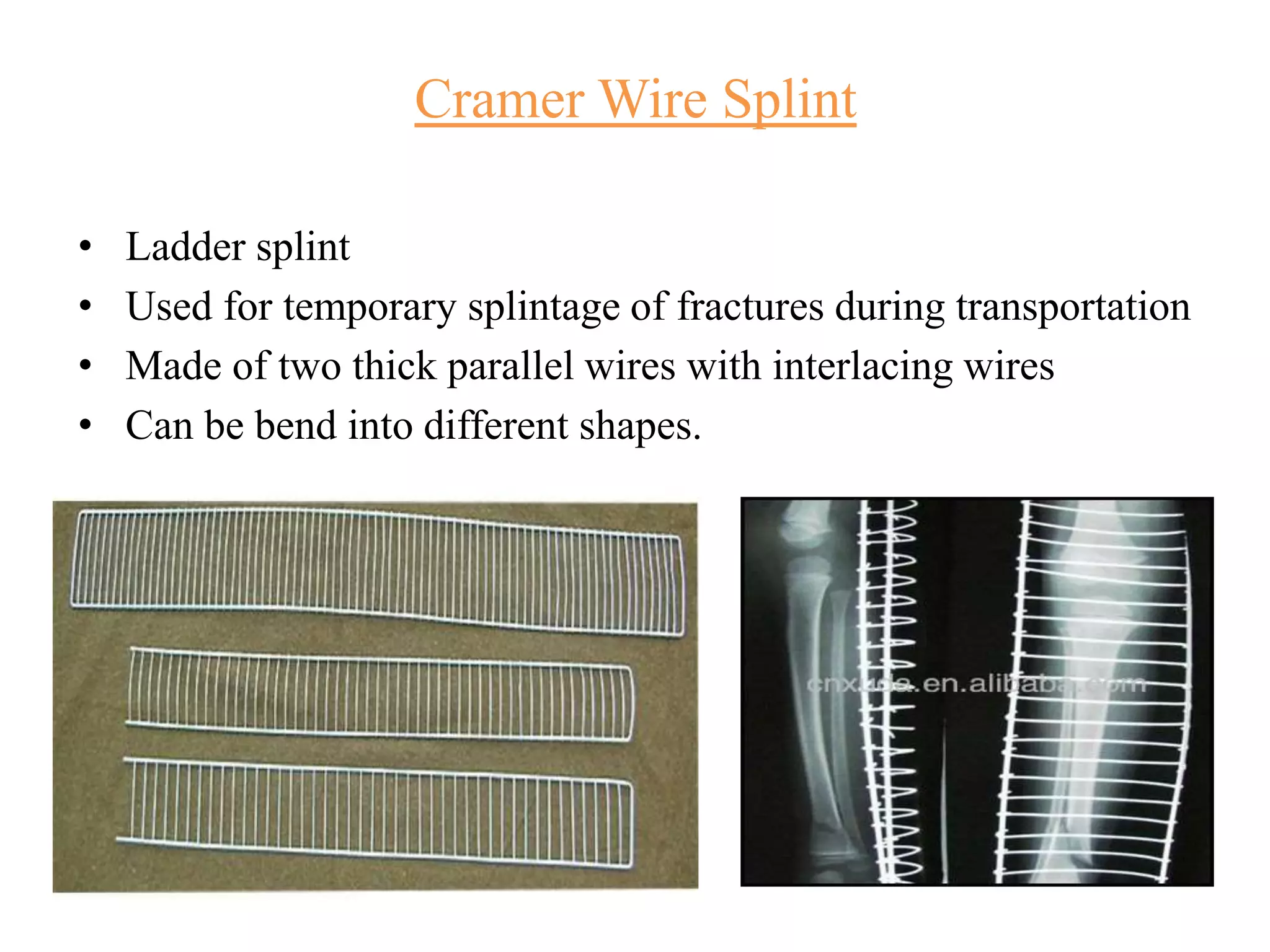 Tractions in Orthopaedics.ppt