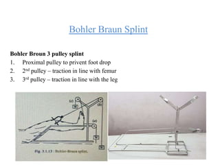 Tractions in Orthopaedics.ppt