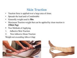 Tractions in Orthopaedics.ppt