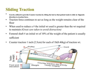 Tractions in Orthopaedics.ppt