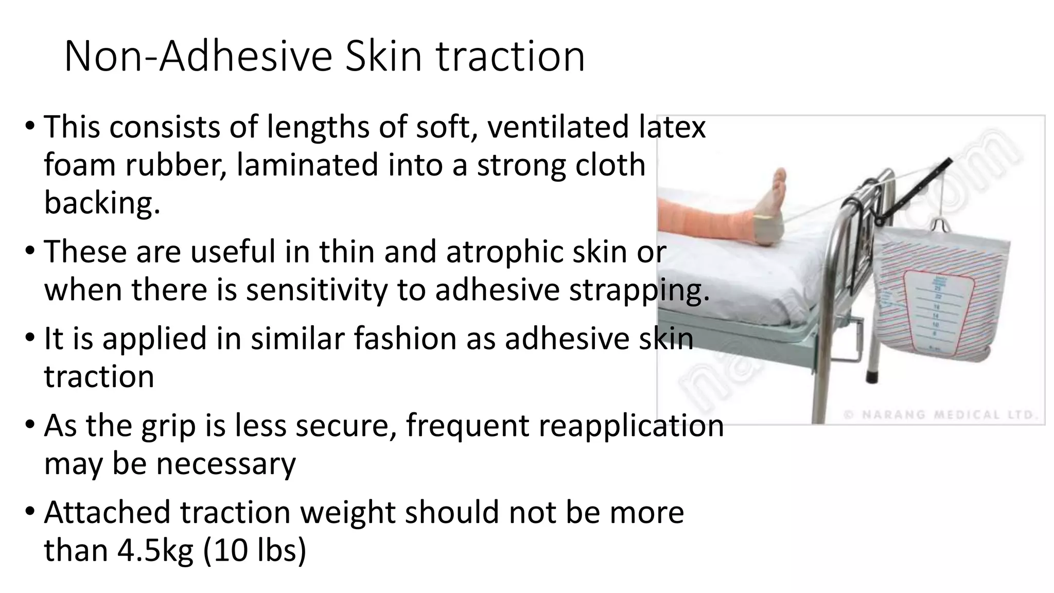 Tractions in orthopaedics by Dr O.O. Afuye | PPTX