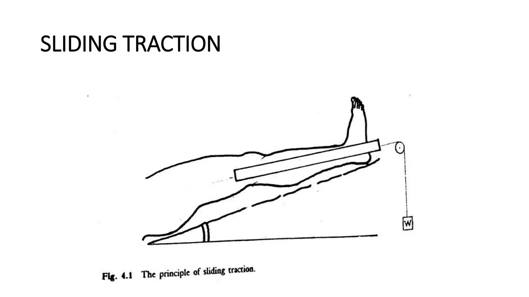 Tractions in orthopaedics by Dr O.O. Afuye | PPTX