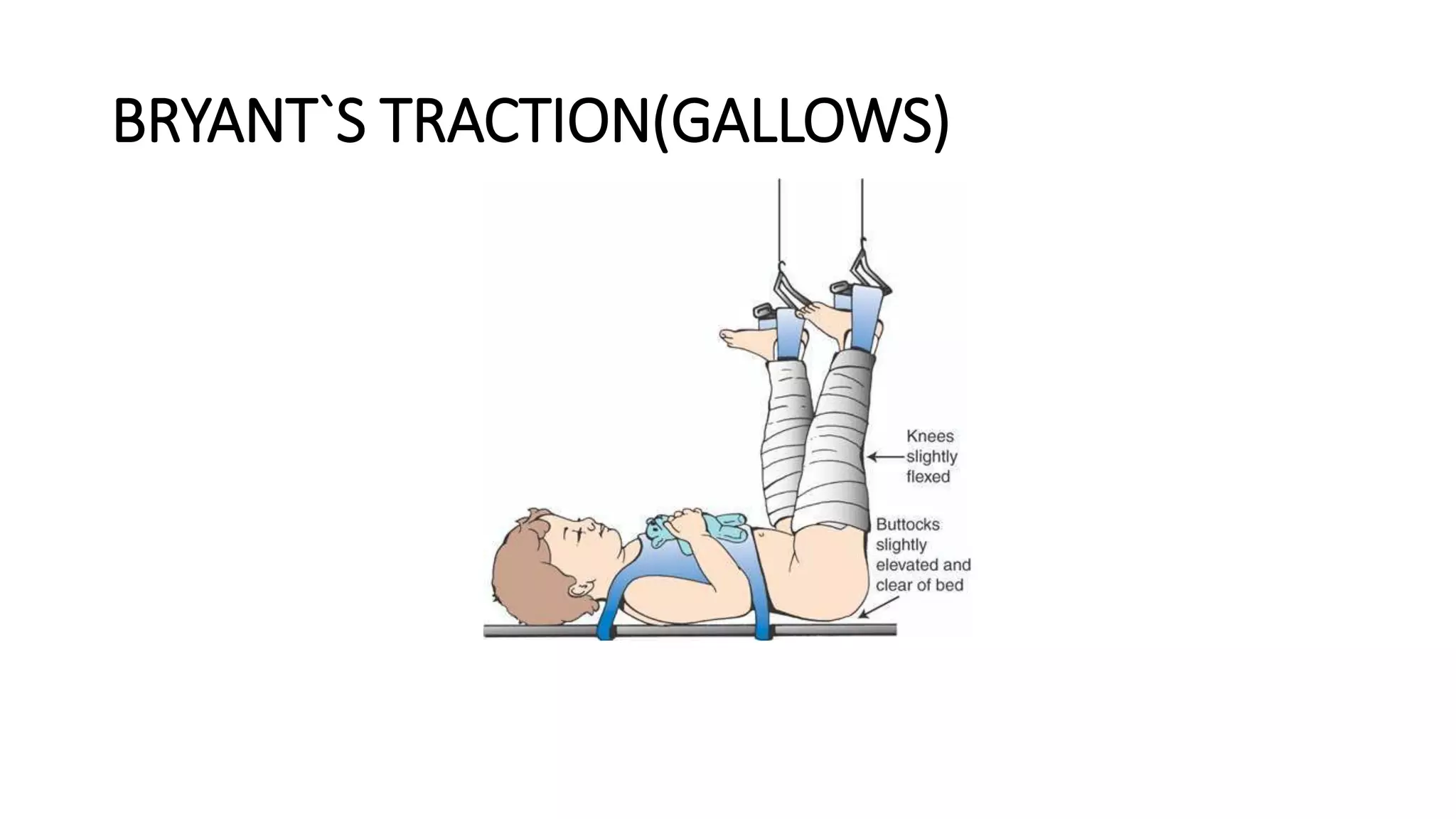 Tractions in orthopaedics by Dr O.O. Afuye | PPTX