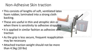 Tractions in orthopaedics by Dr O.O. Afuye | PPTX