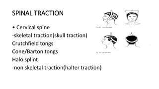 Tractions in orthopaedics by Dr O.O. Afuye | PPTX