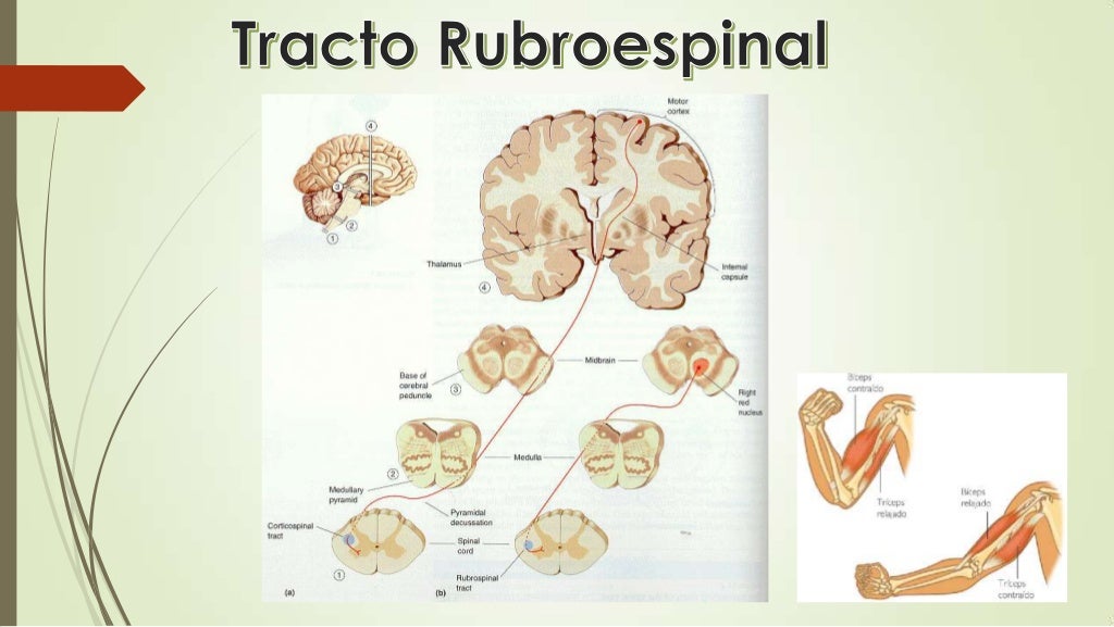 Tractos - Vía piramidal y extrapiramidal