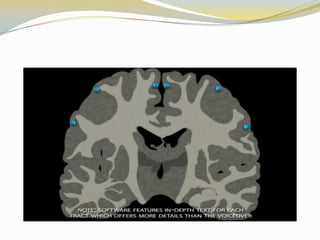 Tracts of spinal cord (1) | PPTX