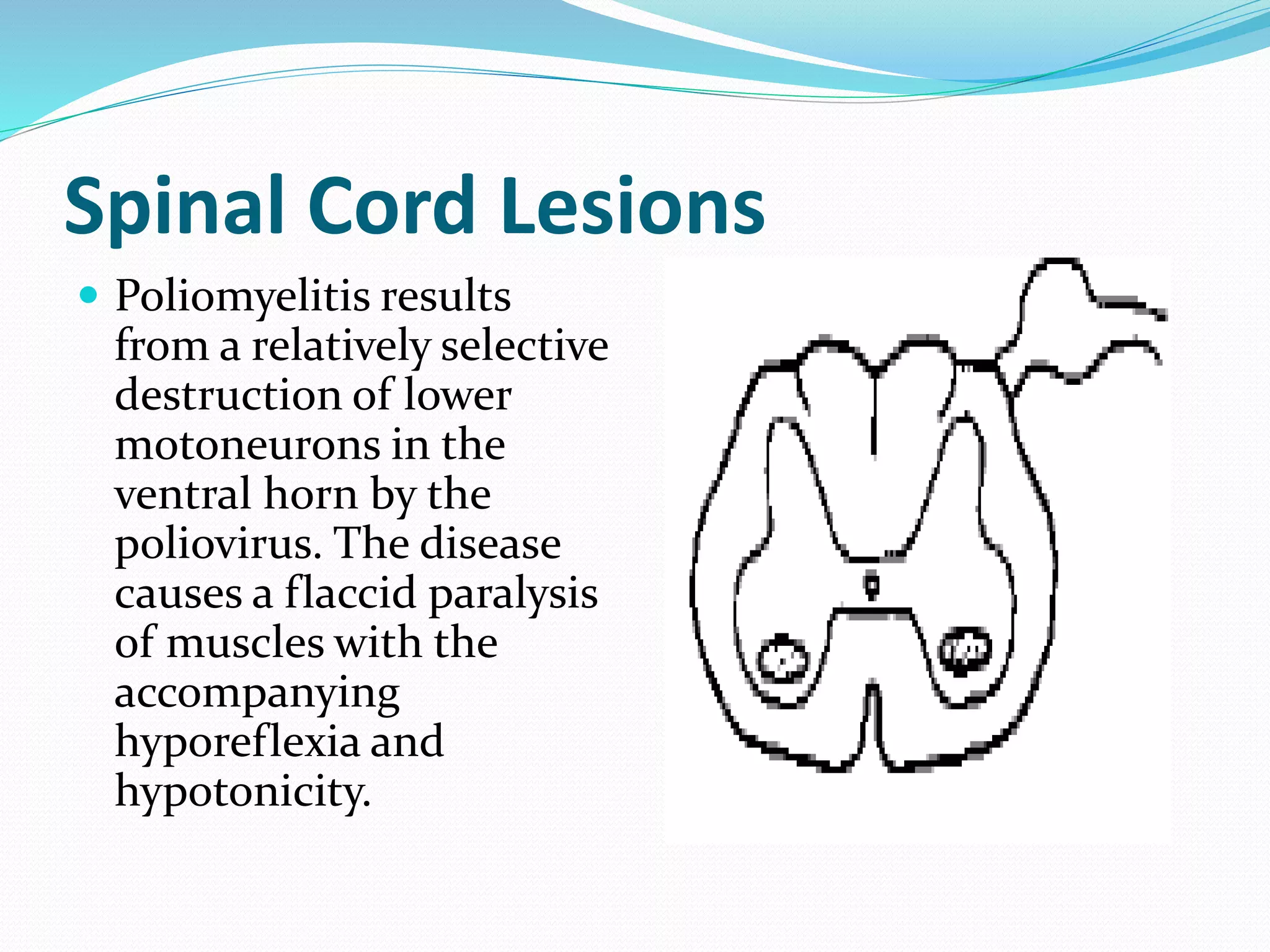 TRACTS OF THE SPINAL CORD.pptx