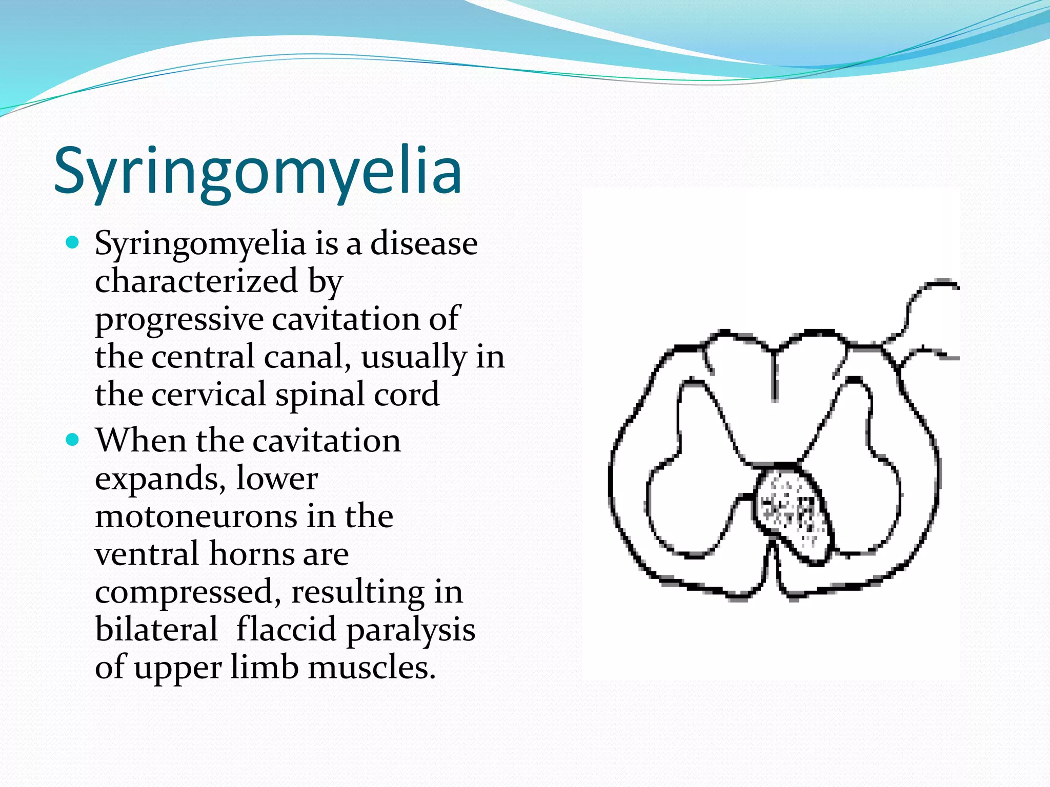 TRACTS OF THE SPINAL CORD.pptx
