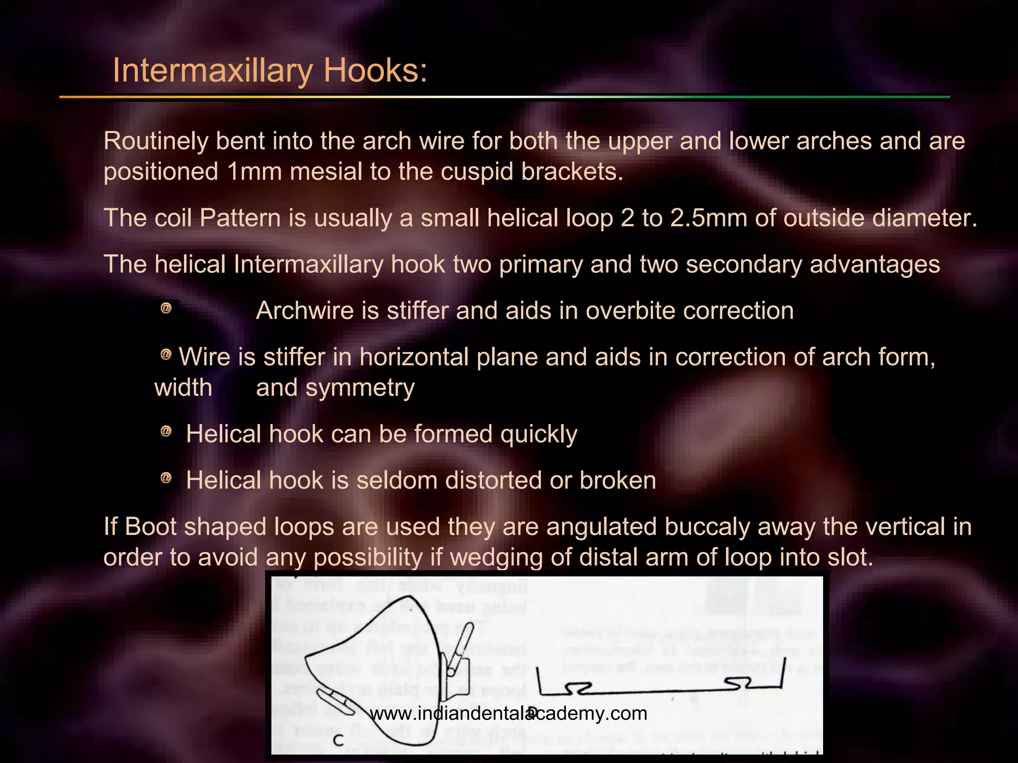 Traditional begg technique stage 1 and stage 2 | PPT