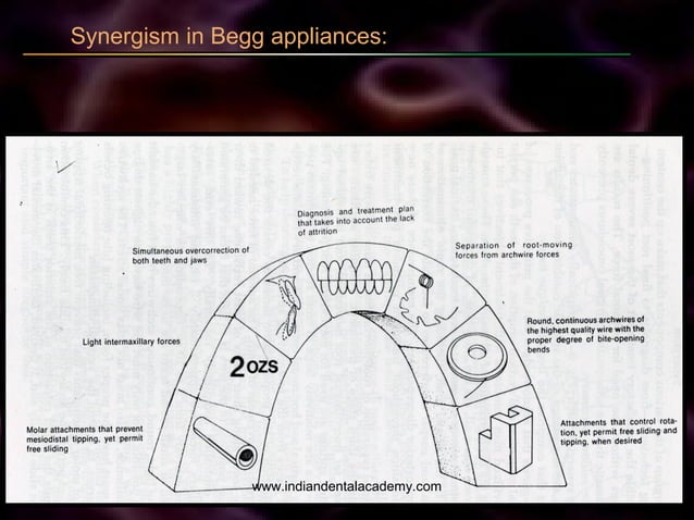 Traditional begg technique stage 1 and stage 2 | PPT | Dental Health ...