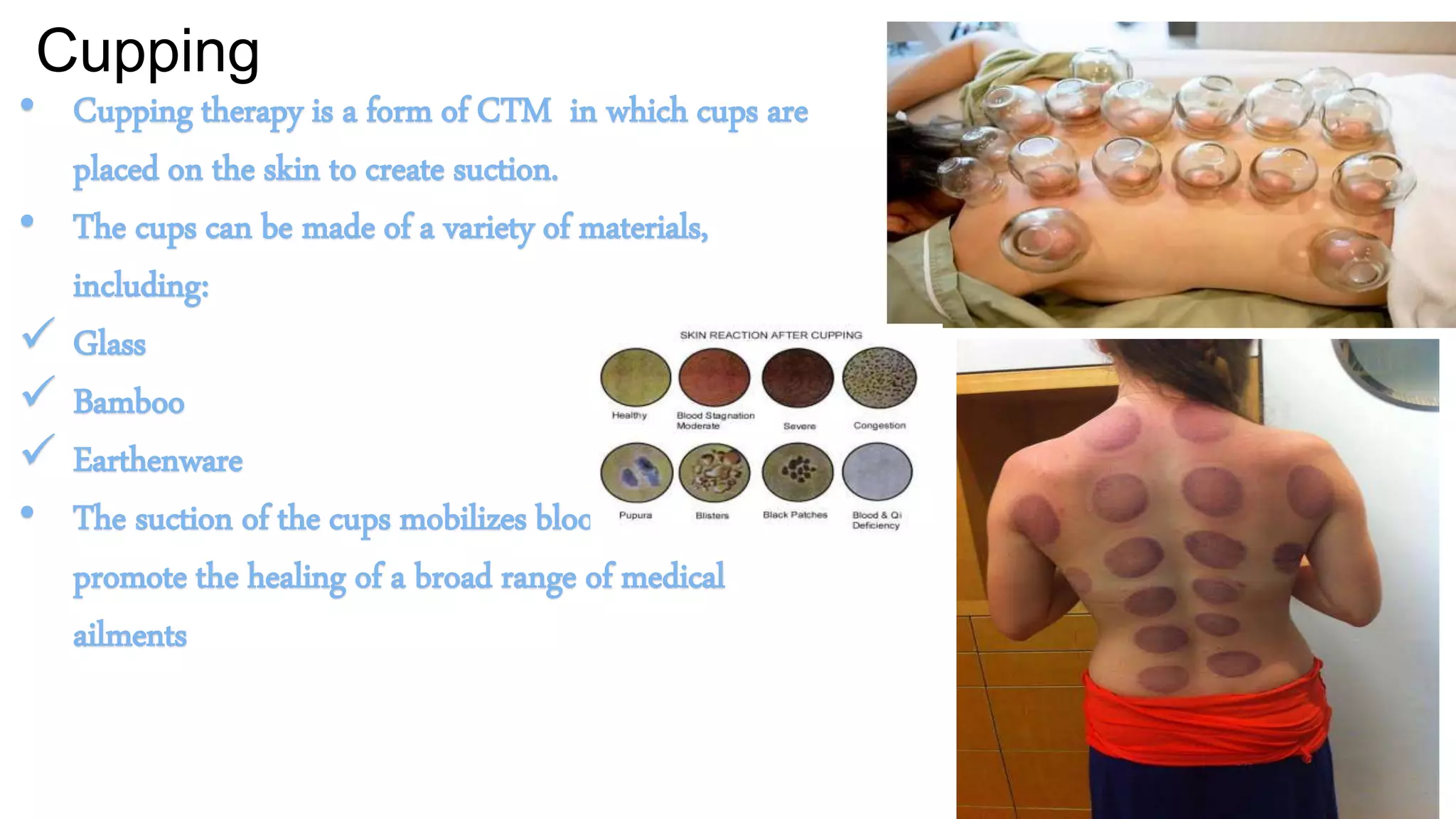 Traditional chinese medicine | PPTX