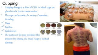 Traditional chinese medicine | PPTX
