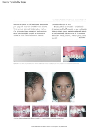 traductor Arco utilitario de rickets versatilidad clinica | PDF