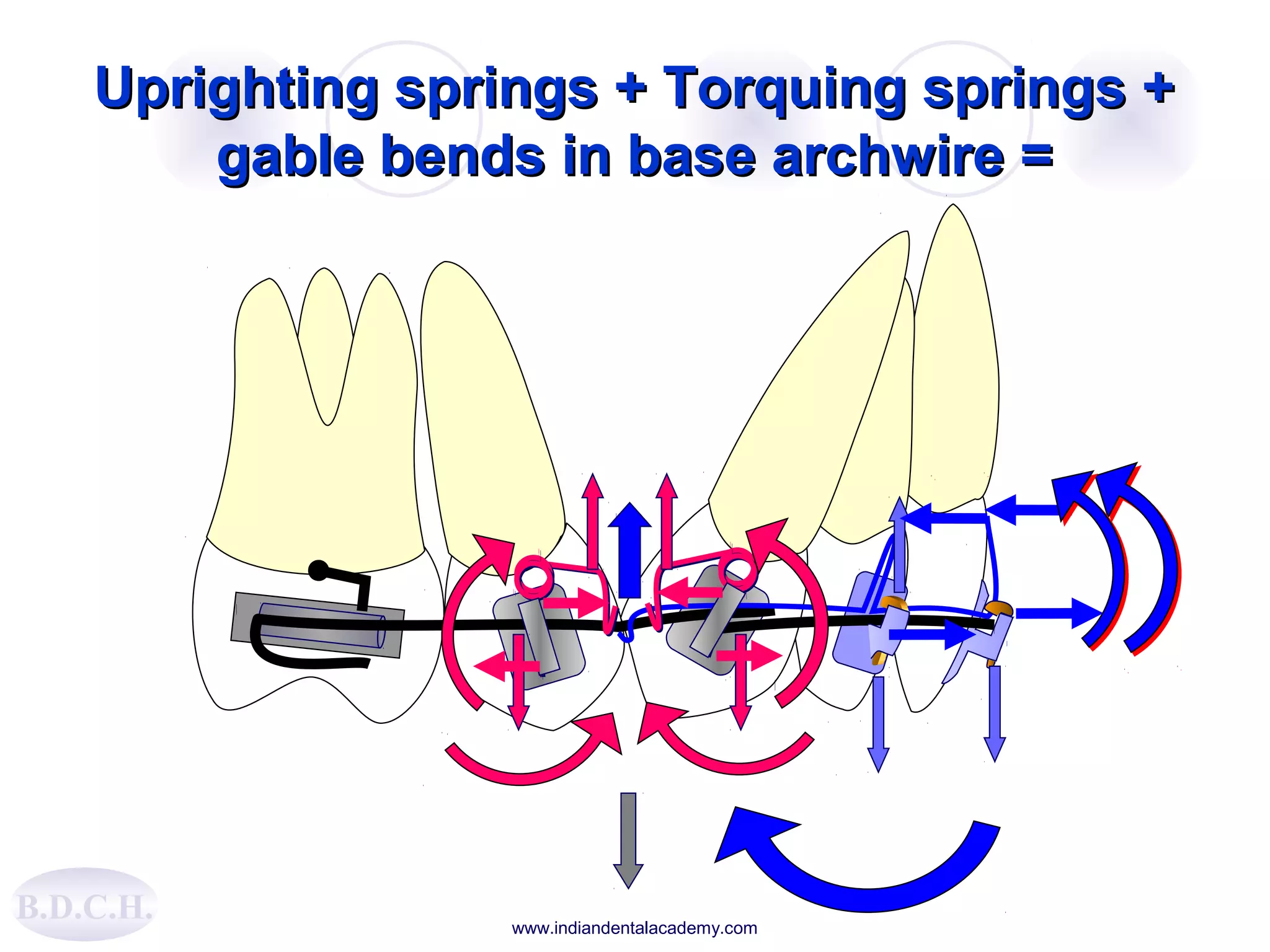 Tragedy of begg technique | PPT