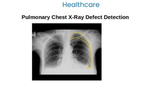 Training and deploying an image classification model | PPT