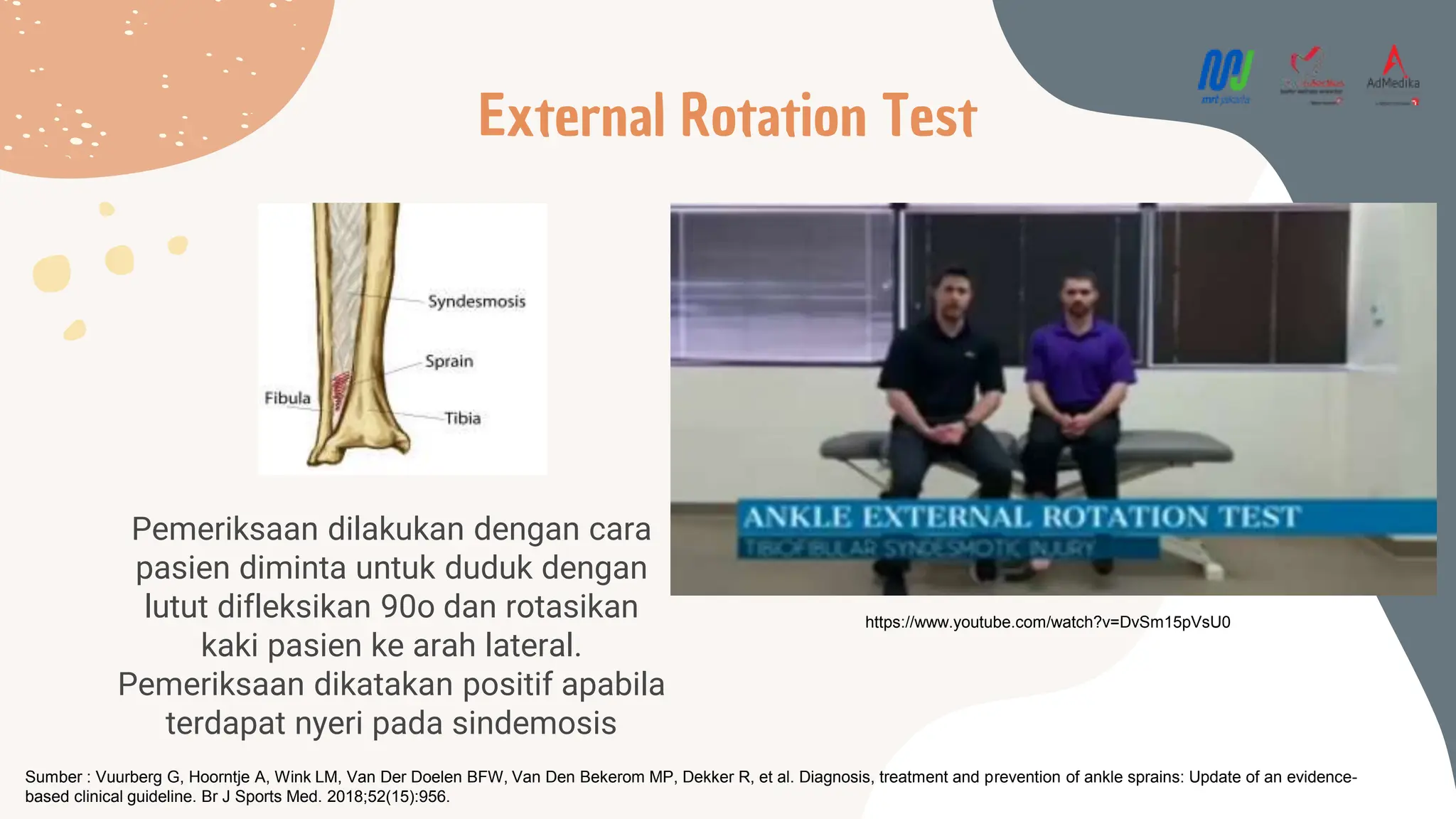 Ankle Sprain | PPTX