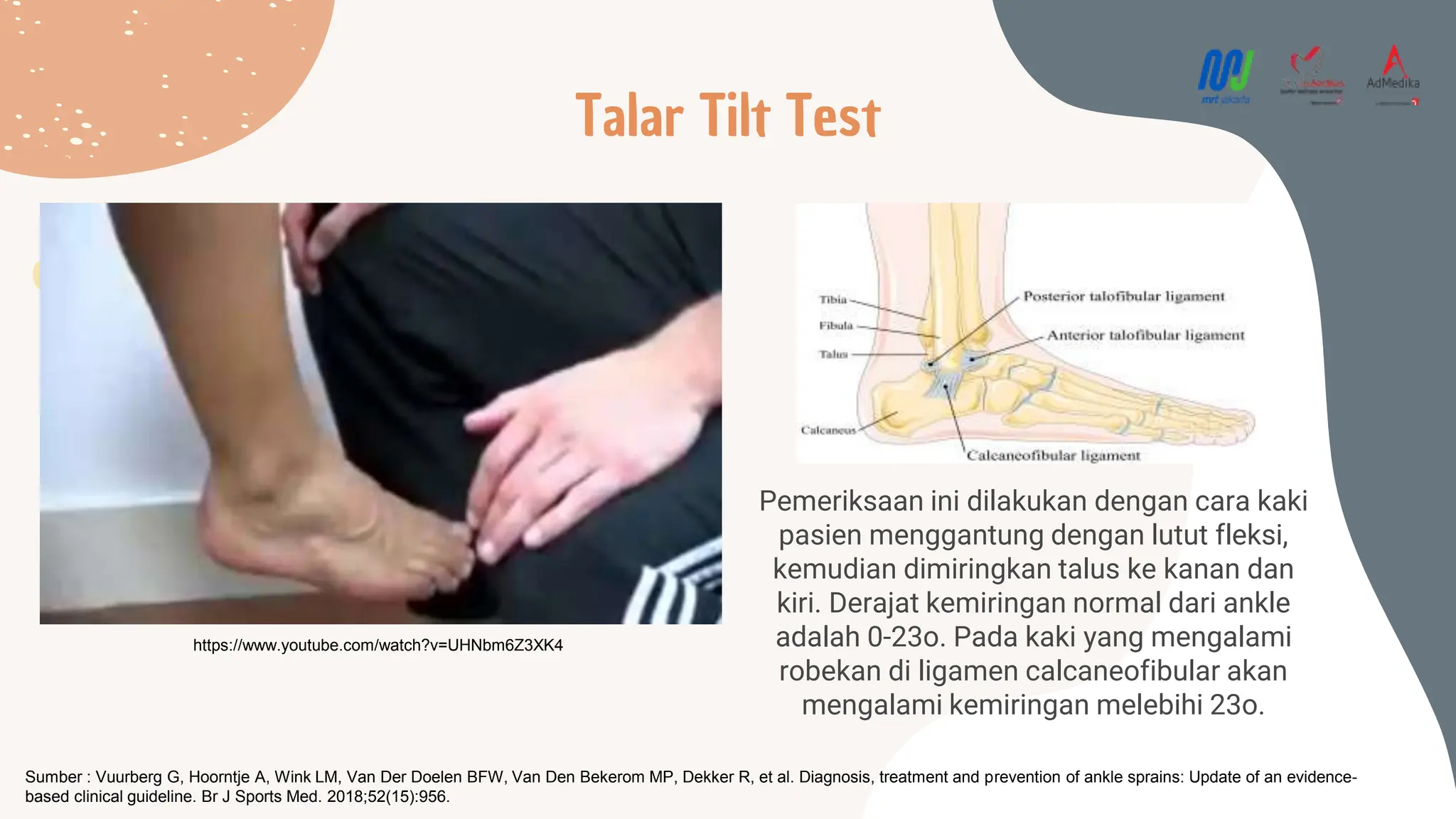 Ankle Sprain | PPTX