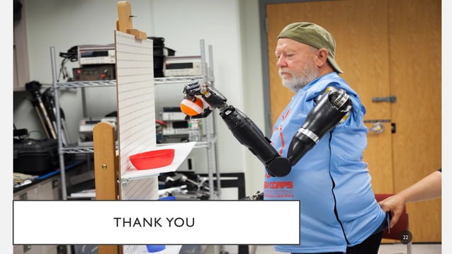 Training Bilateral Trans-humeral Amputee | PPTX