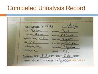 Training module III - Urinalysis | PPTX