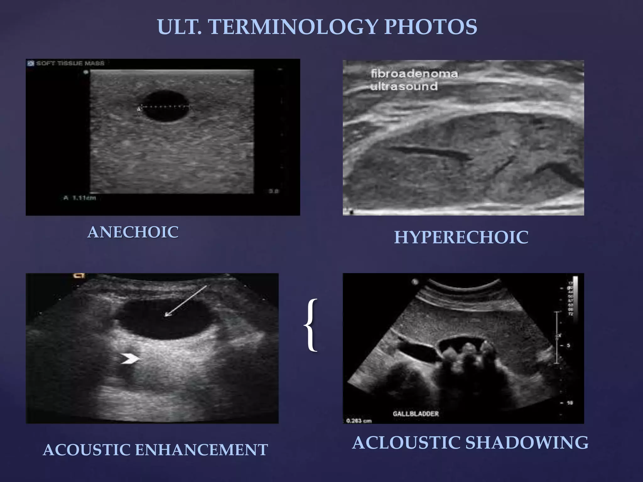 BASIC OBSTETRIC ULTRASOUND TRAINING | PPTX