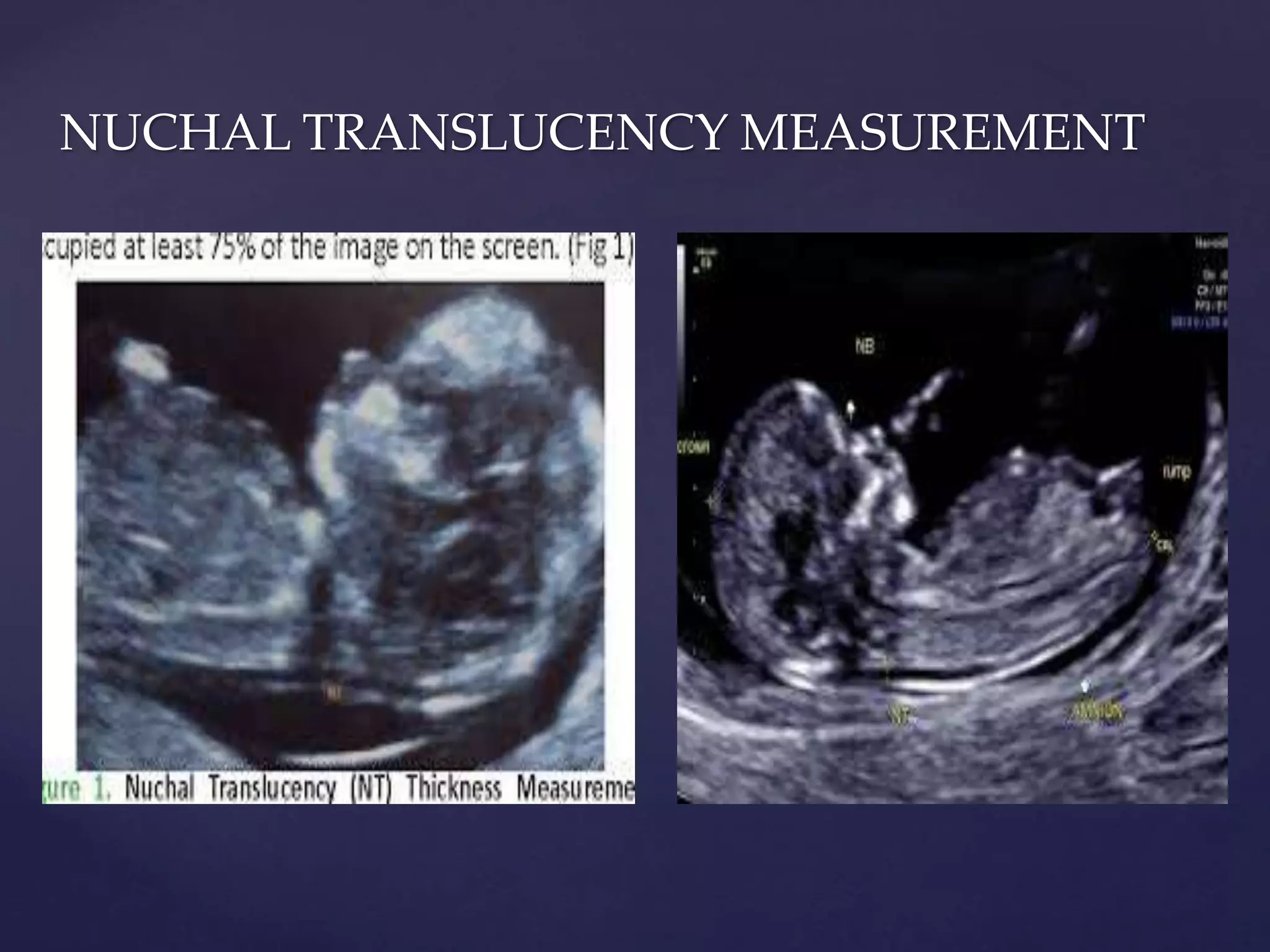 BASIC OBSTETRIC ULTRASOUND TRAINING | PPTX
