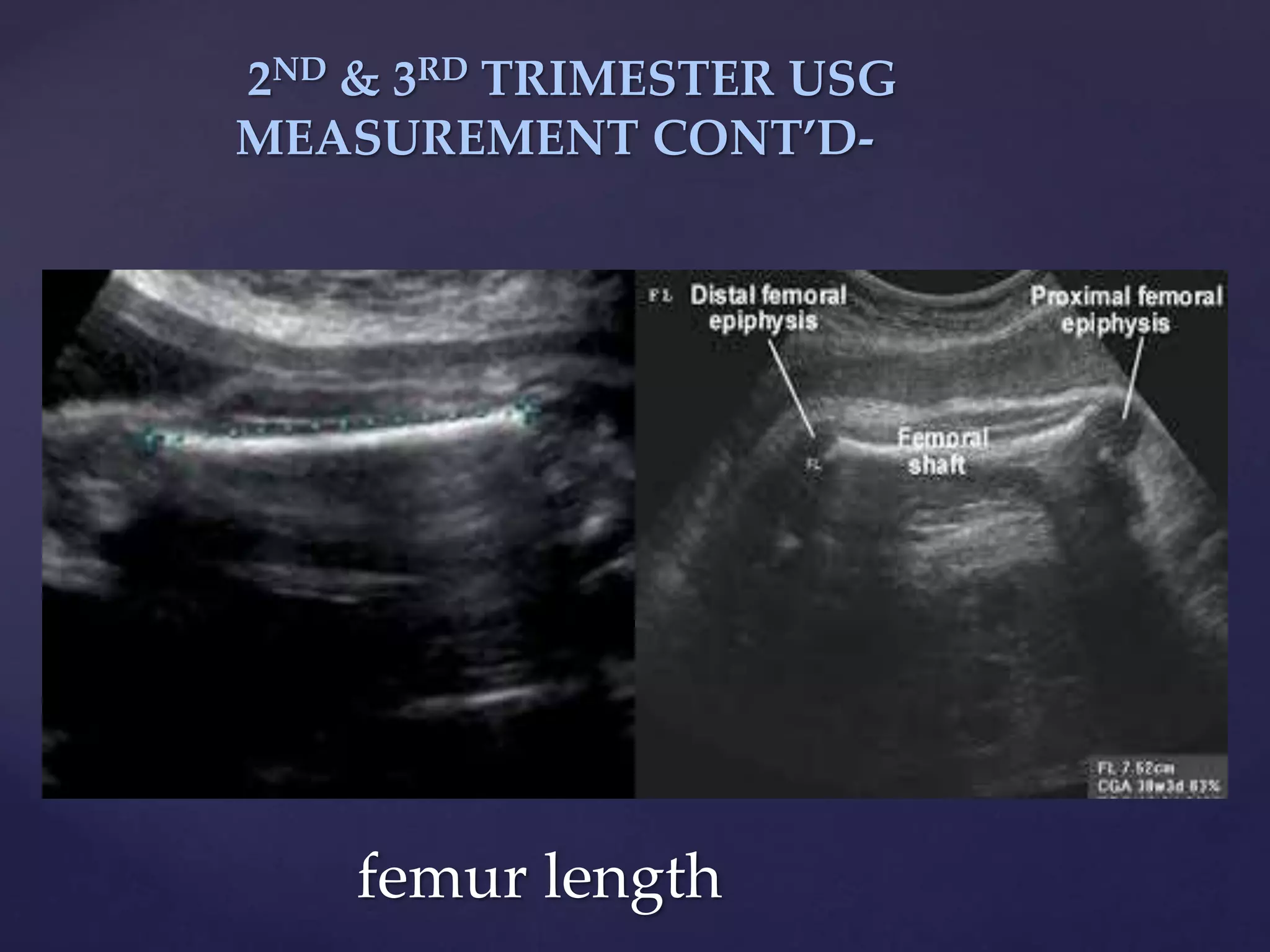 BASIC OBSTETRIC ULTRASOUND TRAINING | PPTX