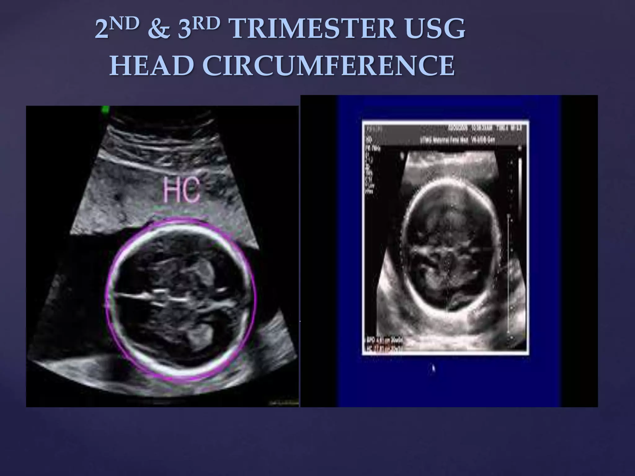 BASIC OBSTETRIC ULTRASOUND TRAINING | PPTX