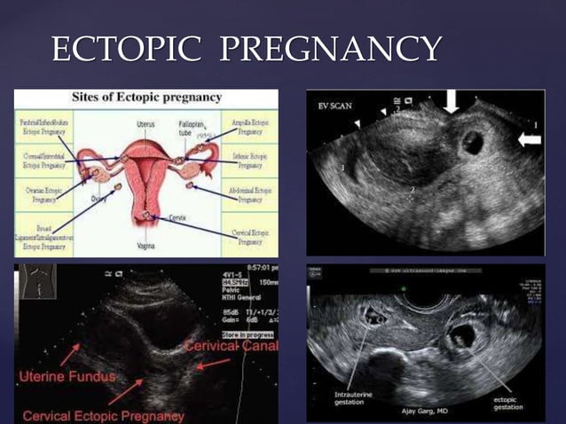 BASIC OBSTETRIC ULTRASOUND TRAINING | PPTX | Pregnancy | Reproductive ...