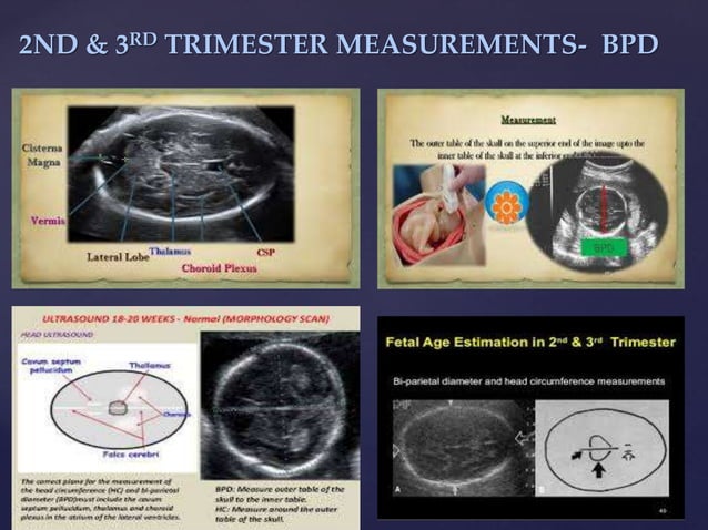 BASIC OBSTETRIC ULTRASOUND TRAINING | PPTX | Pregnancy | Reproductive ...